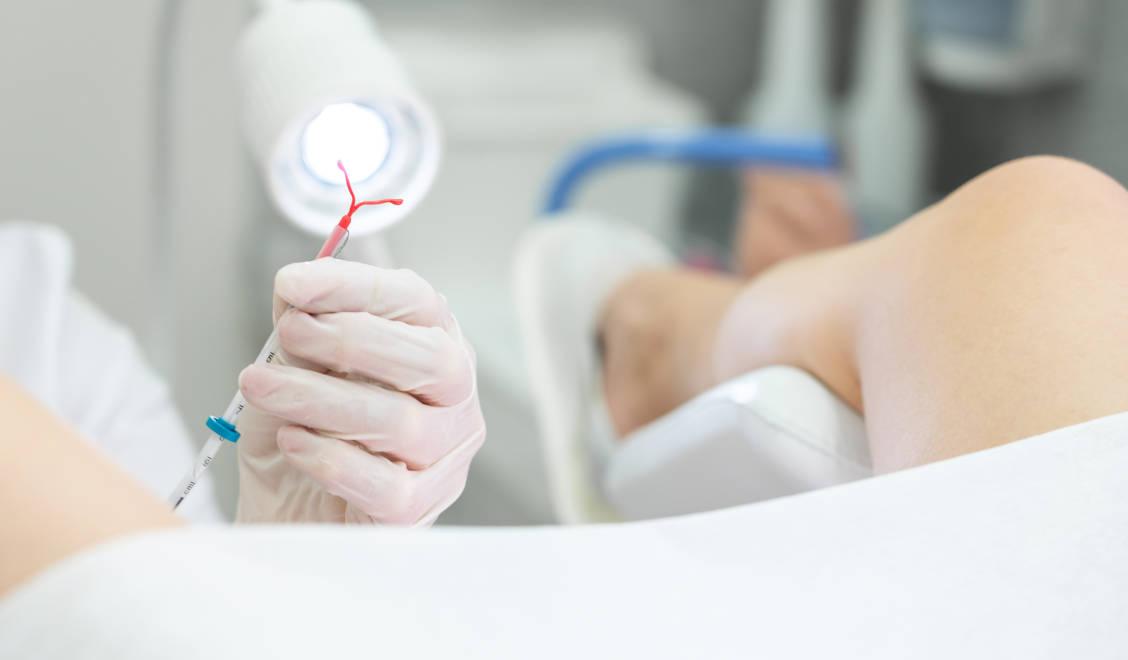 Mengenal 2 Jenis KB IUD: Hormonal dan Non-Hormonal